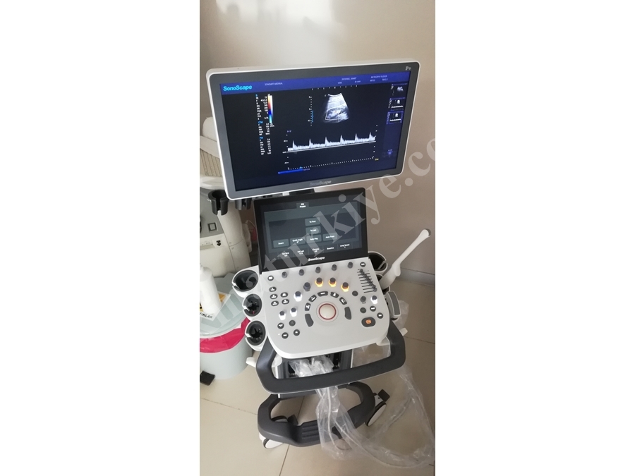 Sonoscape P9 Doppler Usg Sonoscape P9 | makinaturkiye.com